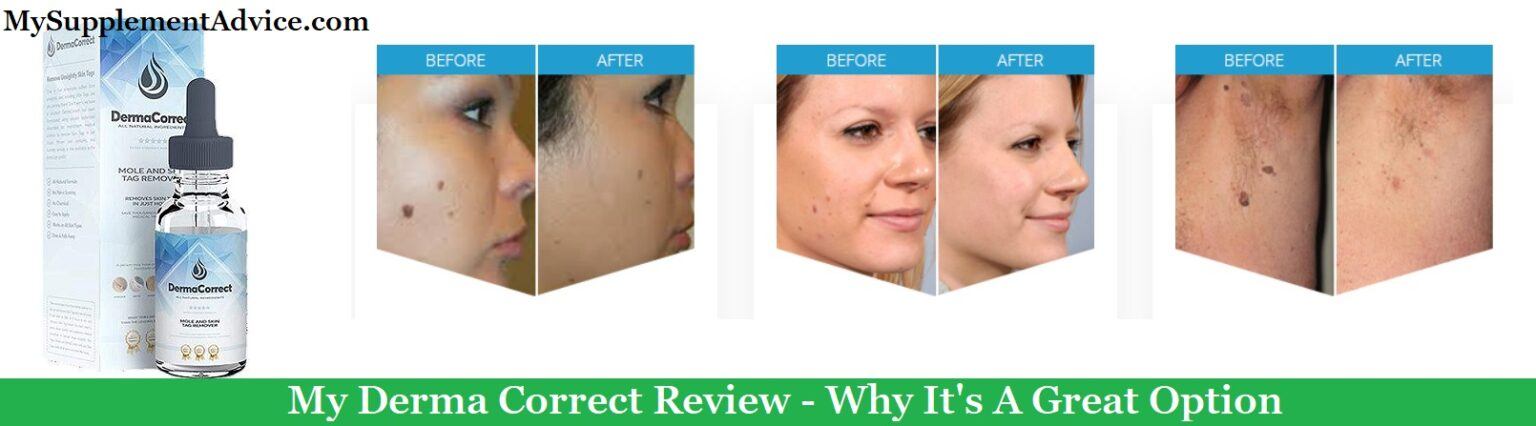 Is Derma Correct A Scam? My Review (2024) - Supplementox