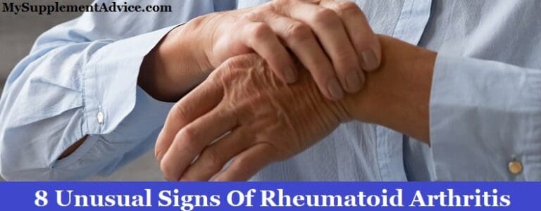 8 Unusual Signs Of Rheumatoid Arthritis - Supplementox